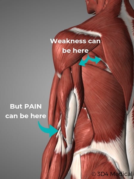 Elbow Pain Treatment & Relief - Geelong Osteopaths