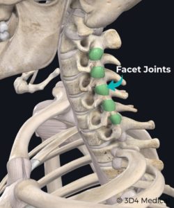Cervical Facet Sprain (Sprained Neck) - Geelong Osteopaths